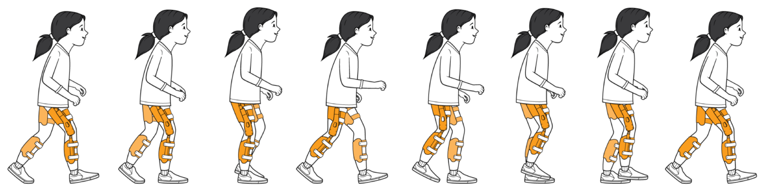 Crouch Gait: Causes, Issues, Treatments – Bionic Power Inc.